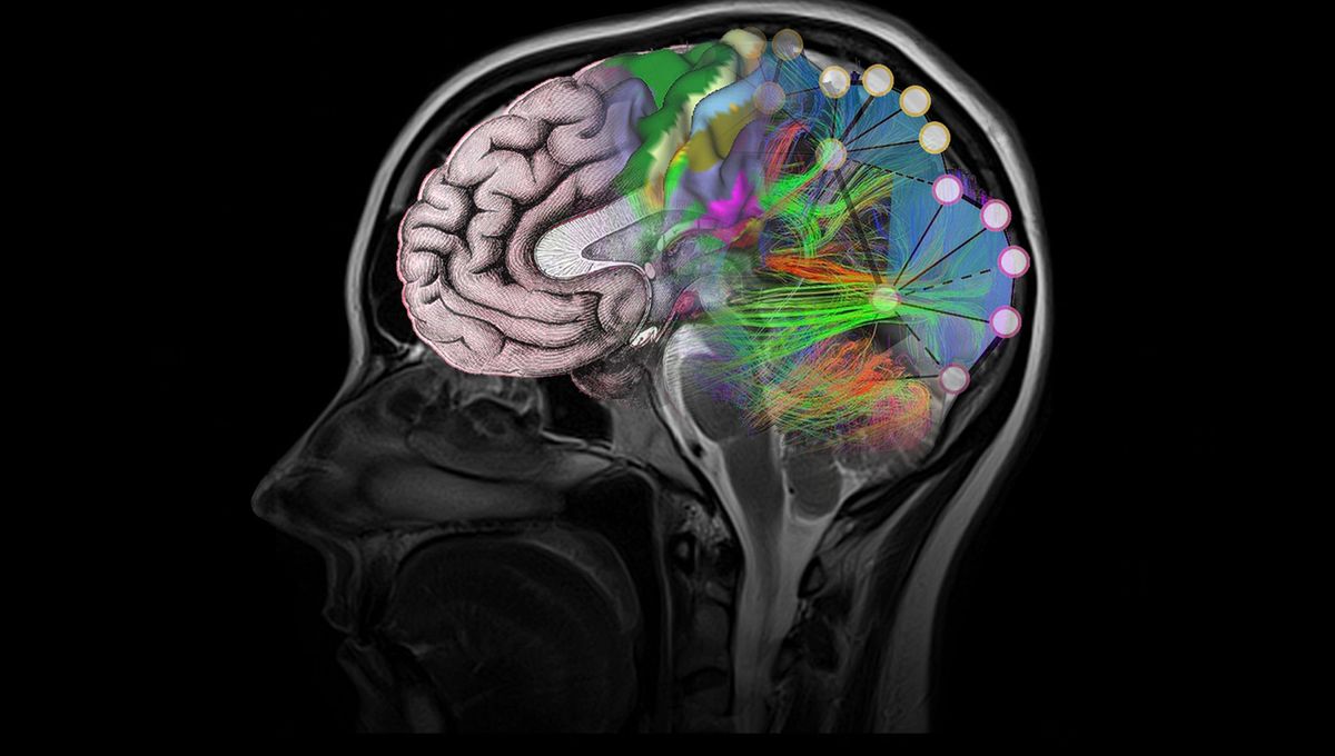 Gray Matter Vs White Matter: What Is In A Brain? | IFLScience