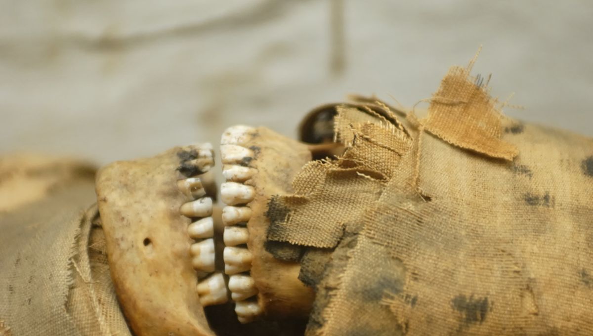How Come Ancient Skulls Often Have Straight Teeth? | IFLScience