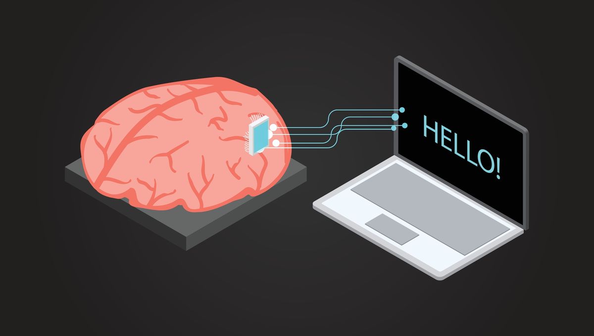 Breakthroughs In Brain-Computer Interfaces To Help Paralyzed Patients ...