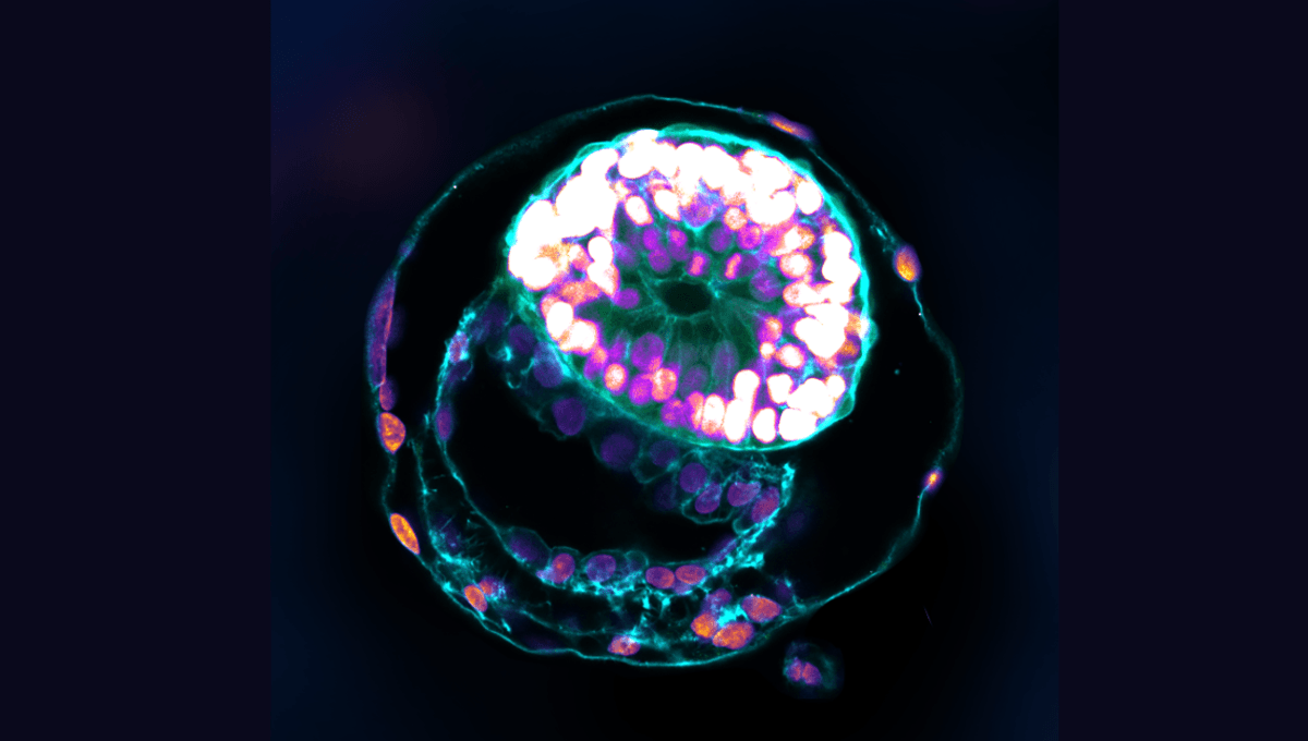 Complex Human Embryos Models Created Using Stem Cells In A Lab | IFLScience