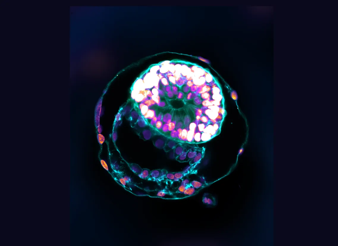 Complex Human Embryos Models Created Using Stem Cells In A Lab ...