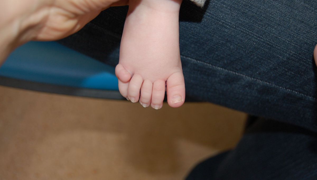 Long Fingers And Toes Syndrome at Eileen Towner blog