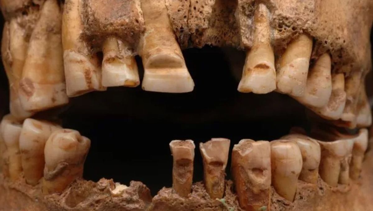 Vikings May Have Modified Their Teeth As A Kind Of Initiation | IFLScience