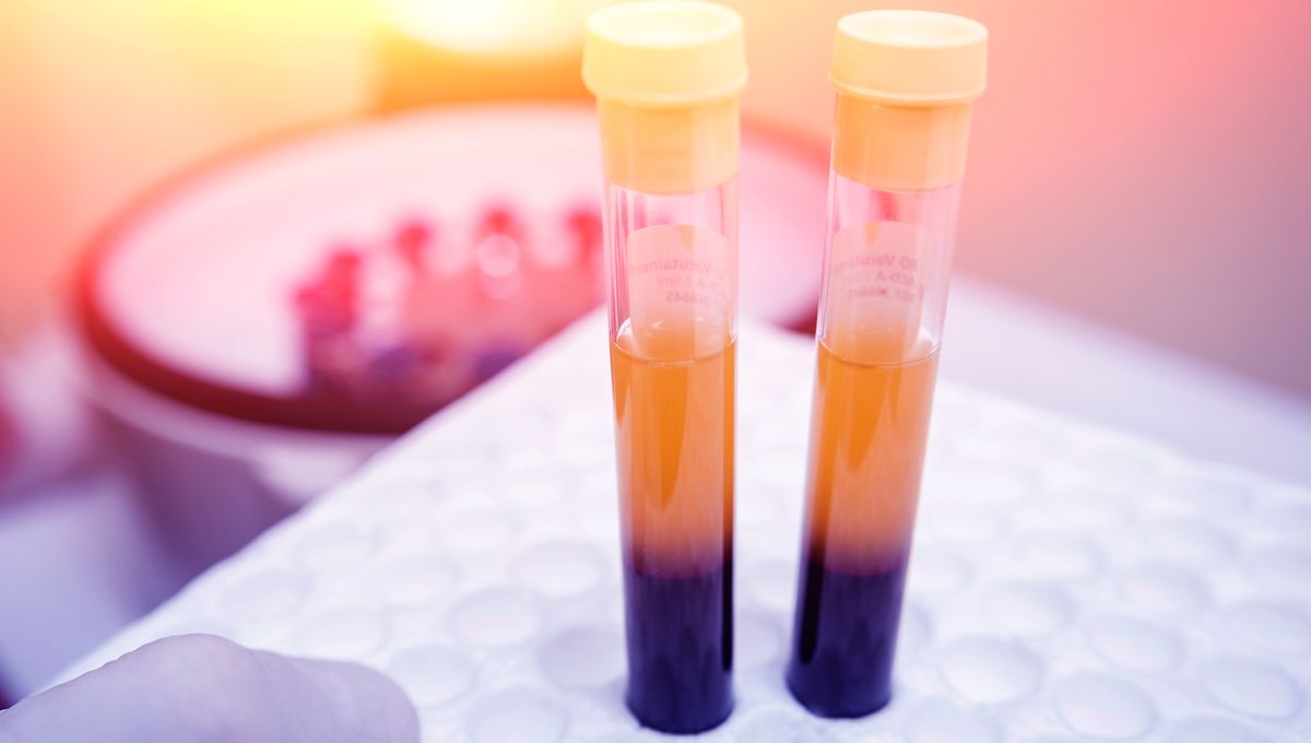 What Is PRP And How Is It Used? | IFLScience