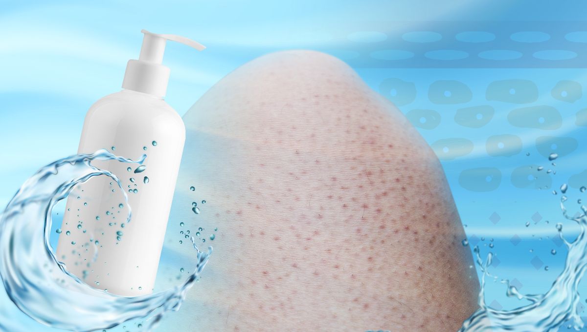 “Chicken Skin” Is A Common Condition, But What Actually Is It? | IFLScience