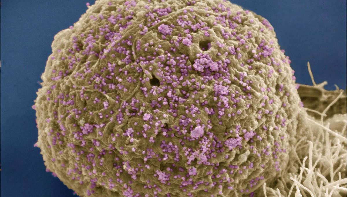 HIV PrEP Injections You Only Need Every 6 Months Are Being Trialed In ...