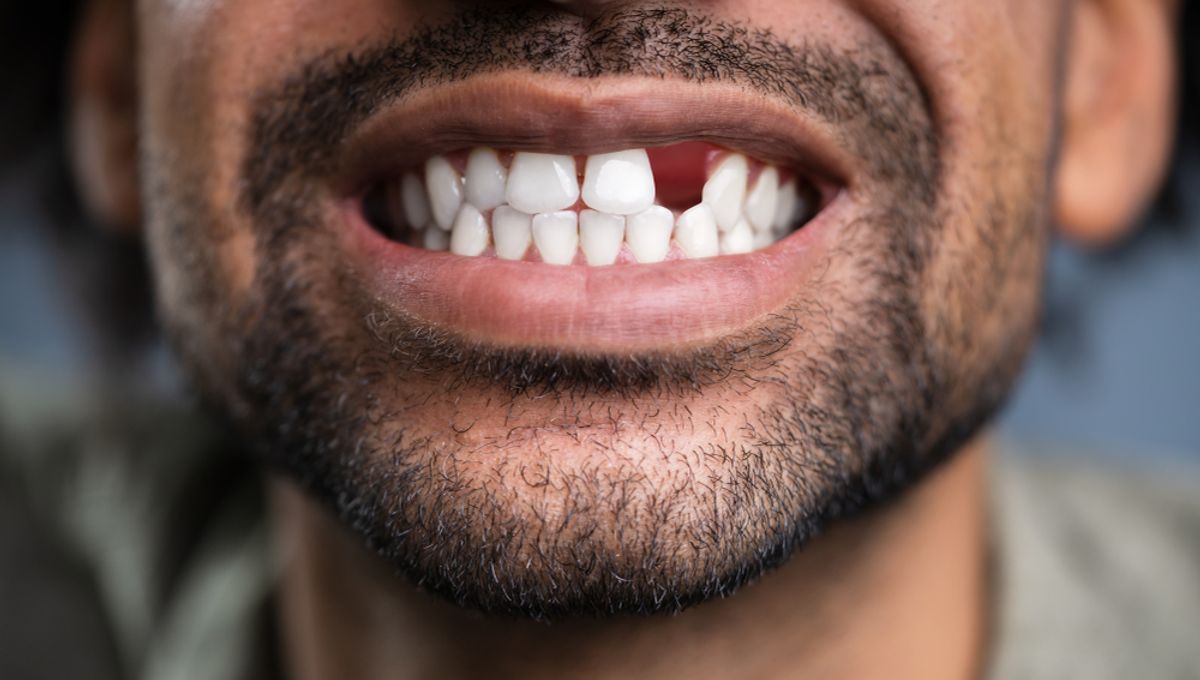 Medicine For Regrowing Teeth To Be Tested On Humans For The First Time ...