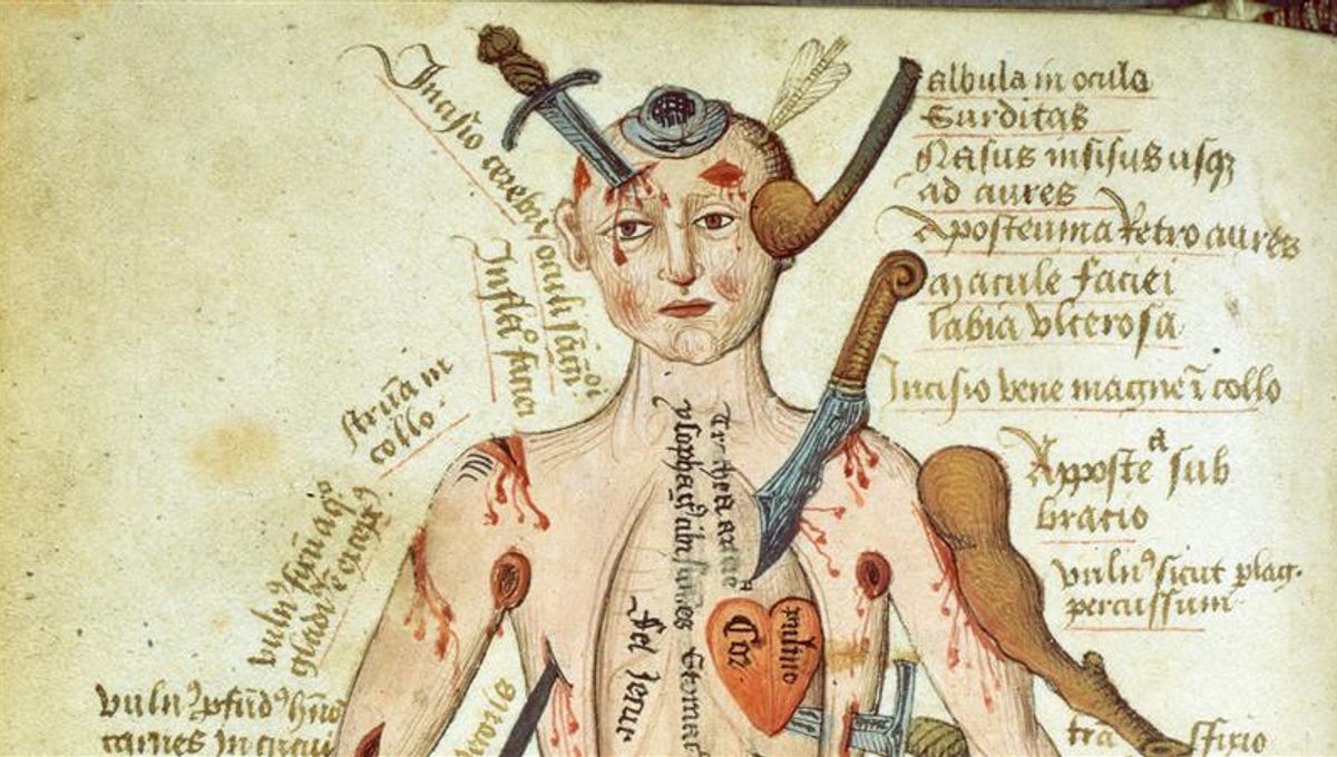 Stabbed, Slashed, And Bleeding: Meet The Medieval “Wound Man” With All The Injuries | IFLScience