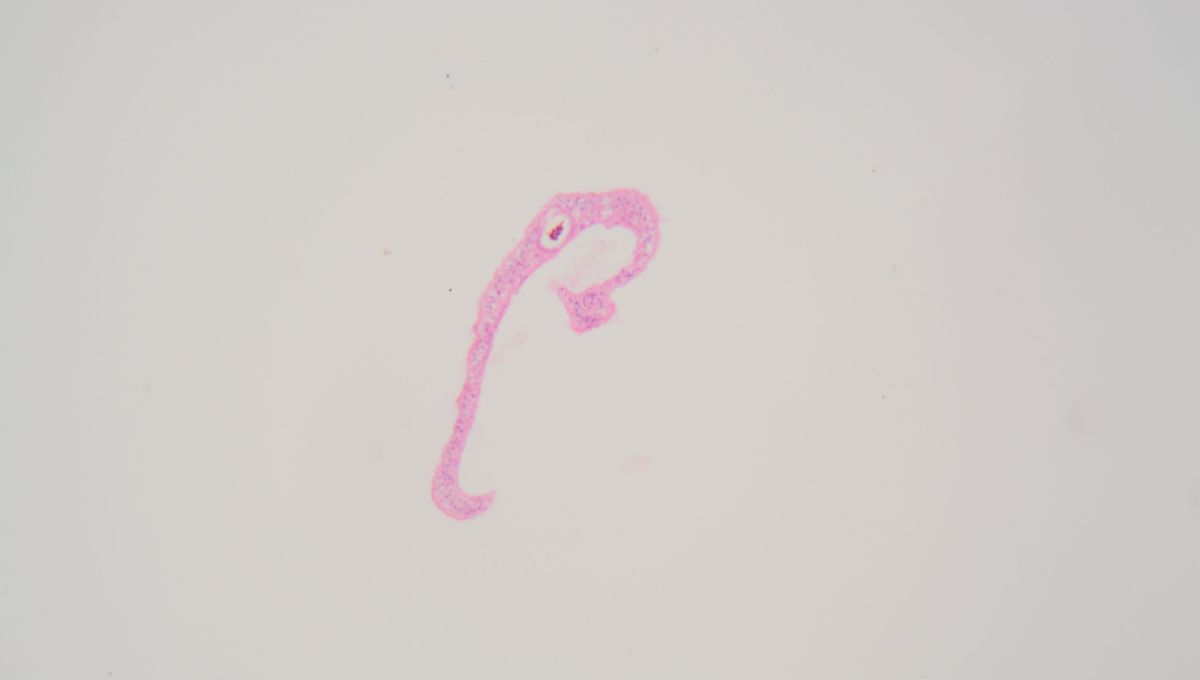 This Parasitic Worm Could Hold The Key To New Alternatives To Opioid ...