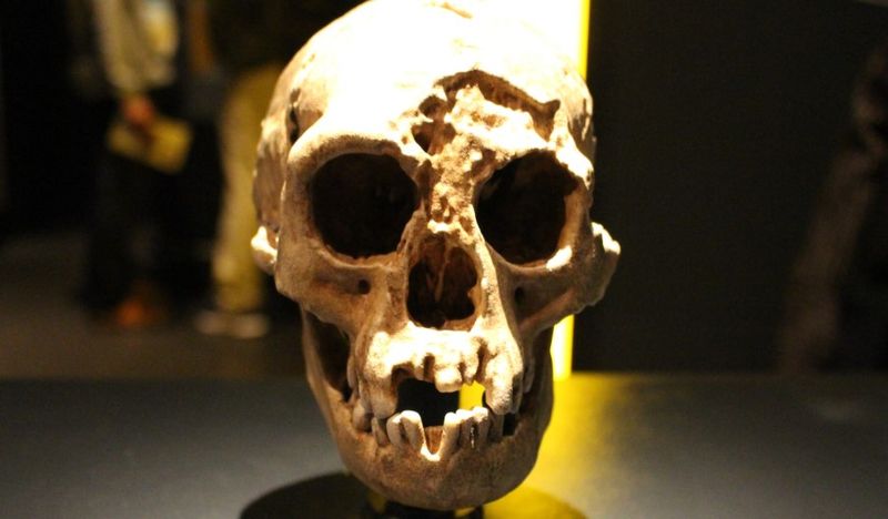 How Come Ancient Skulls Often Have Straight Teeth? | IFLScience