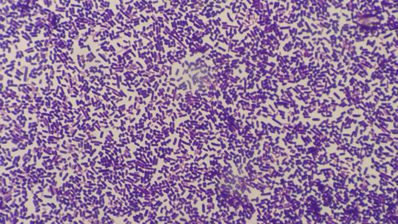 Expanding Earth: The Strange (And Wrong) Hypothesis That The Earth Is ...