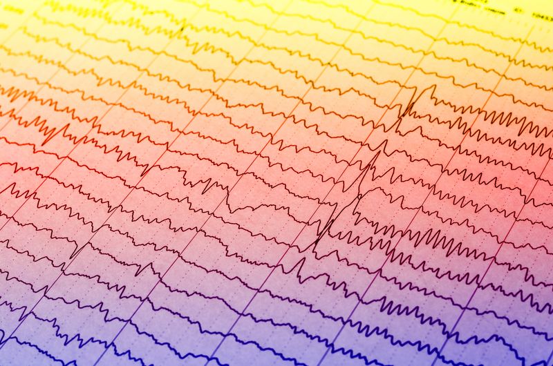 1 Million US Adults Per Year Forecast To Develop Dementia By 2060 ...