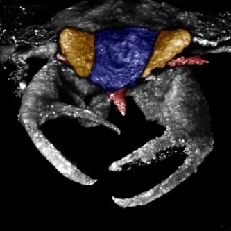 Ancient Amber Reveals 100-Million-Year-Old True Bug With Epic Crab-Like ...