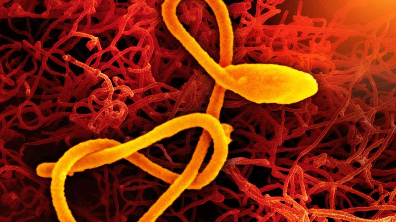 New Combo Blood Test Could Be An Easier Way Of Staging Alzheimer's ...