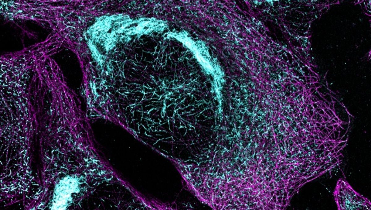 New Combo Blood Test Could Be An Easier Way Of Staging Alzheimer's ...